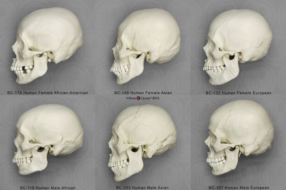 Baby Head Bone Structure Baby Head Bone Structure
