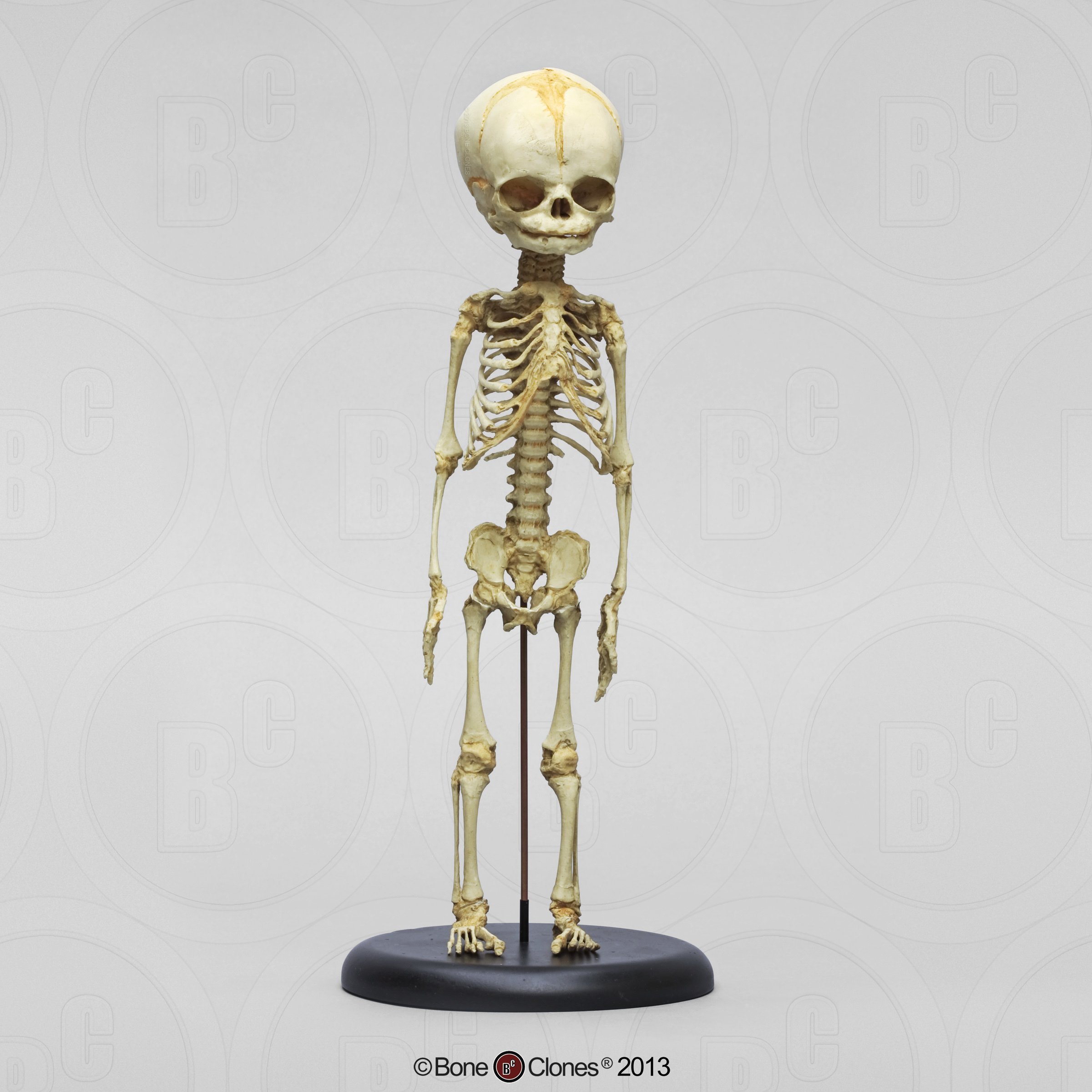How Many Bones In Baby Vedadesignstudio