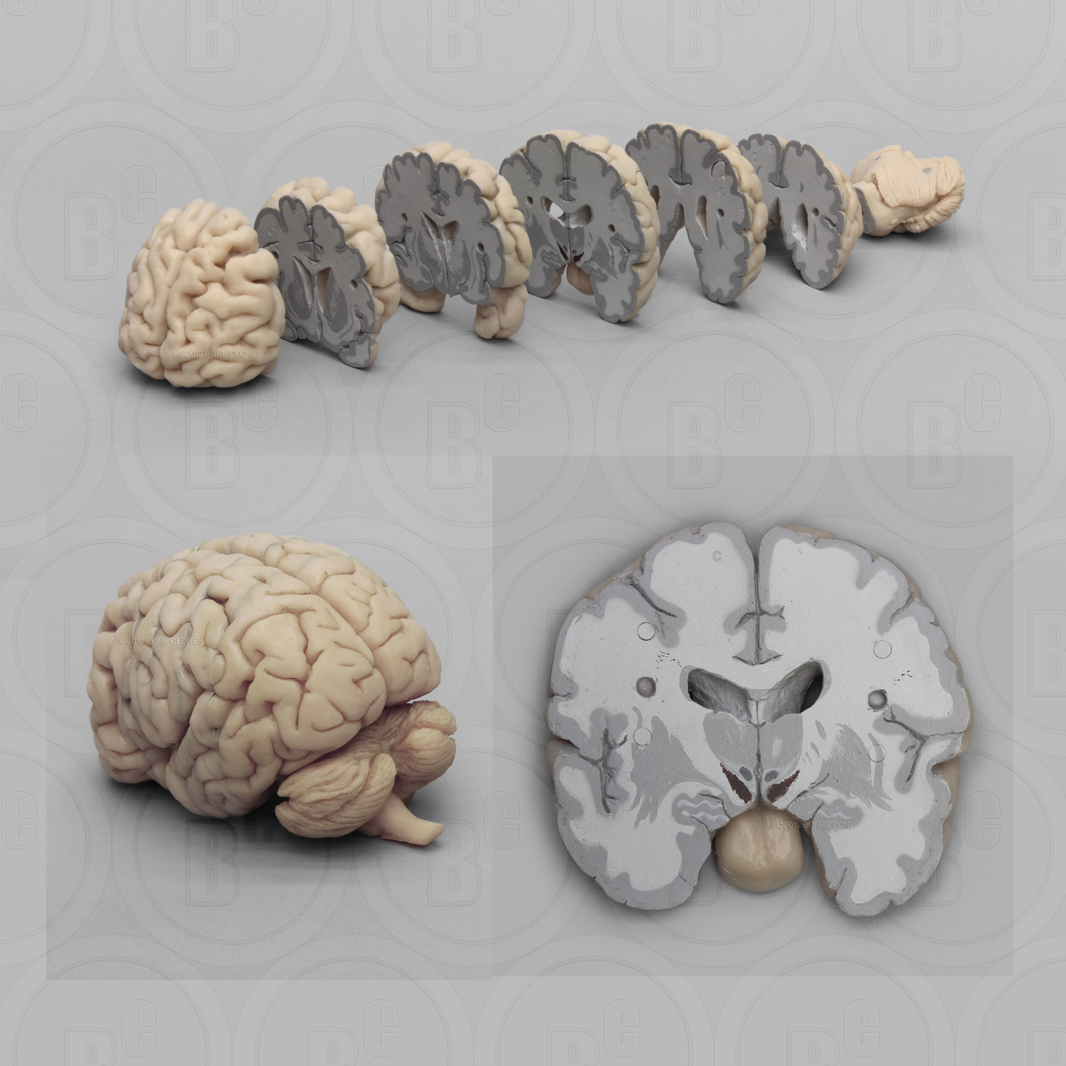 Human Brain Multiple Coronal Sections Bone Clones Inc 